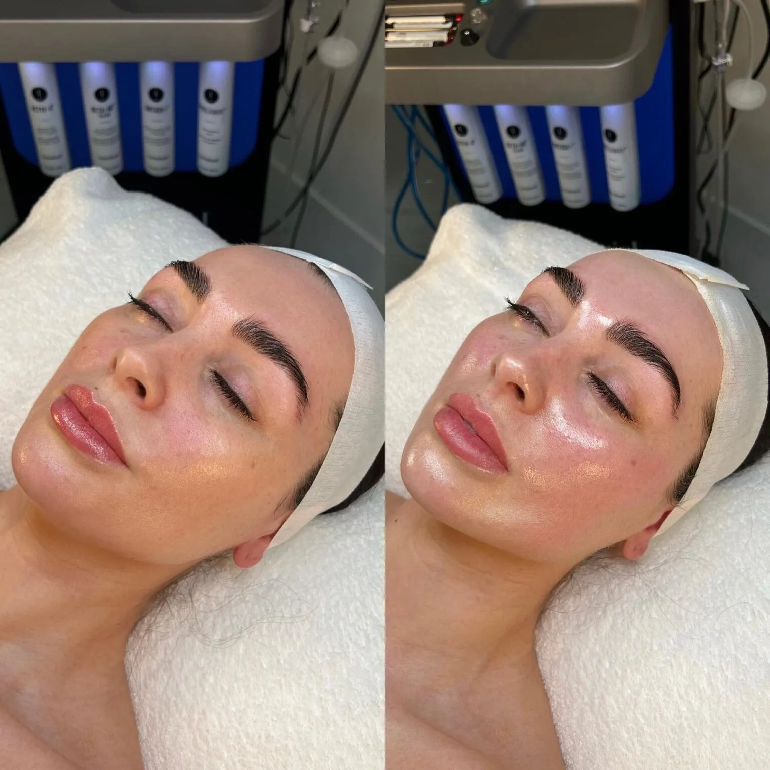 Advanced Booster Serum Treatment Bangkok | Nakhon Spa